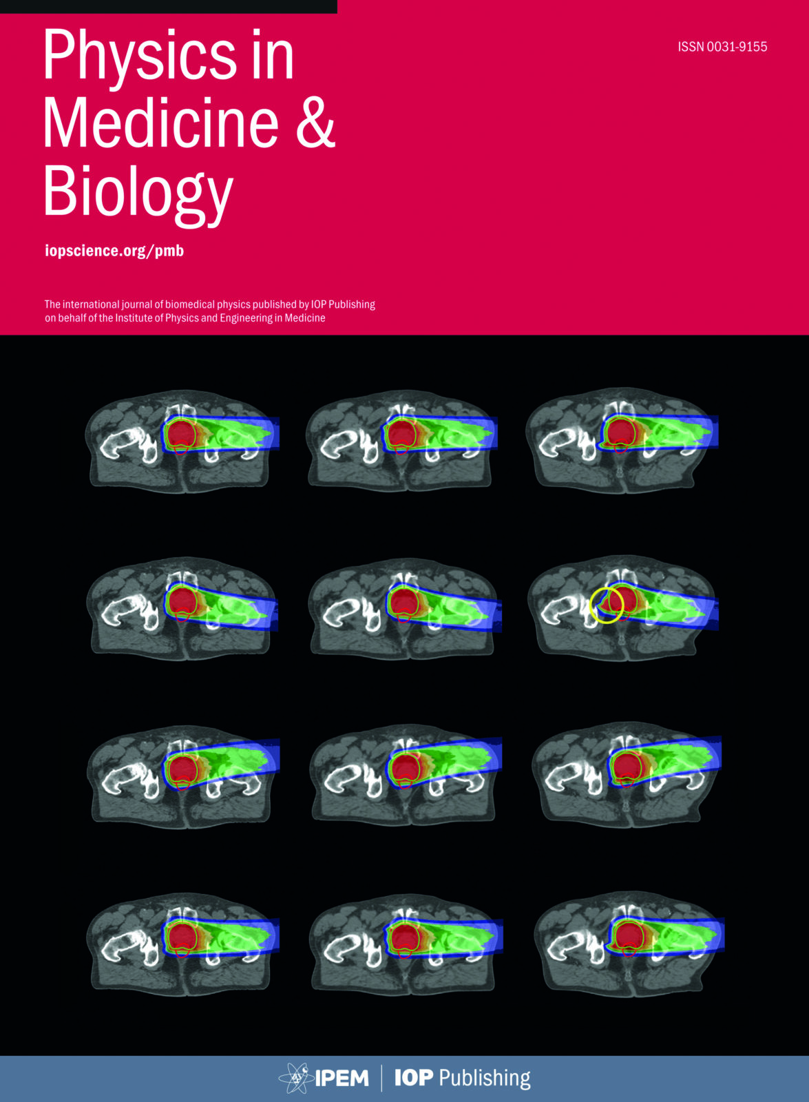 欢迎复旦大学附属肿瘤医院放疗中心胡伟刚研究员新任Physics in Medicine & Biology期刊编委 - IOP China